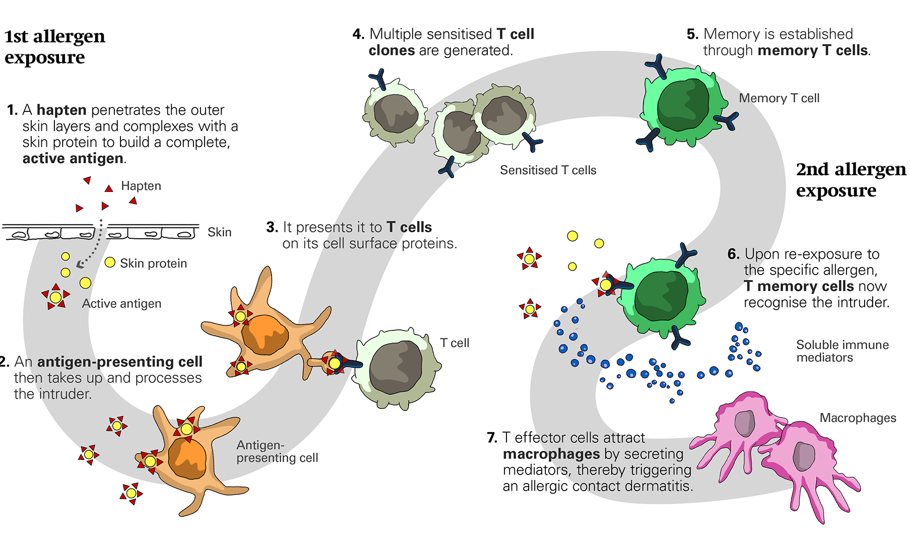 Mechanisms of contact dermatitis and eczema